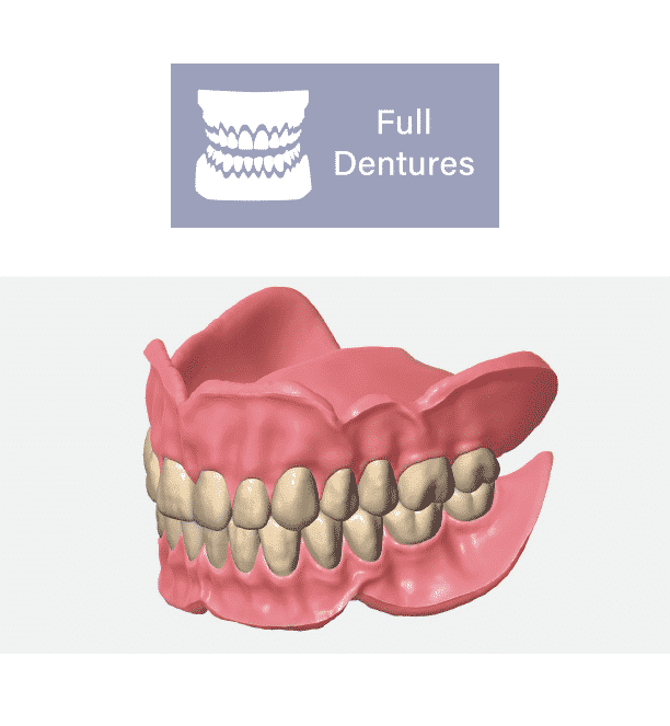 Exocad Full Dentures